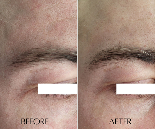 A K Dermal | Professional Skincare – A K Dermal | Advanced Skincare